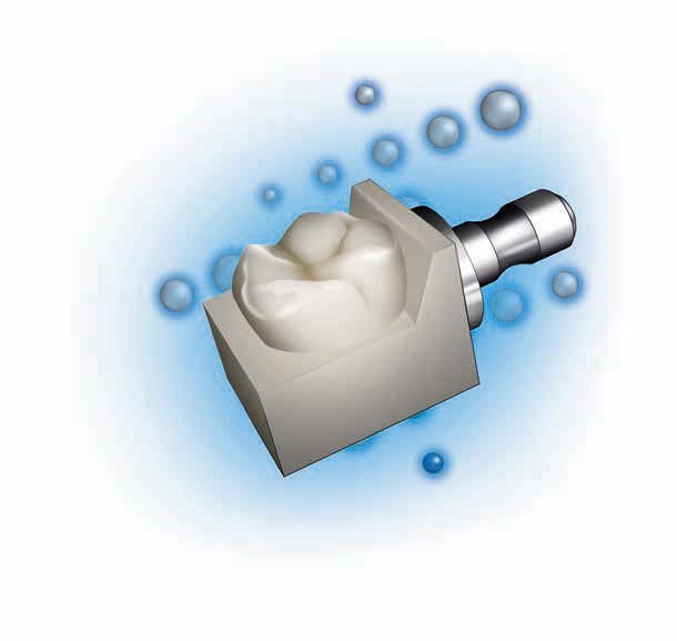 Warum CAD/CAM-Restaurationen aus Composite im Praxisalltag überzeugen ...