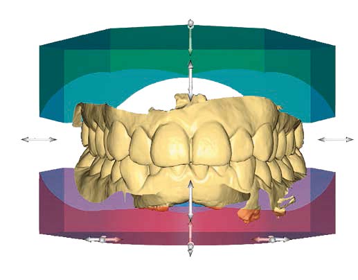 CEREC Orthosoftware – Die Kieferorthopädie wird digital - Digital ...