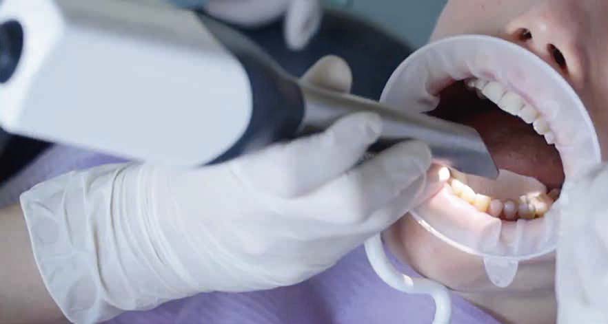 Marktübersicht Intraoralscanner - Digital Dental Magazin